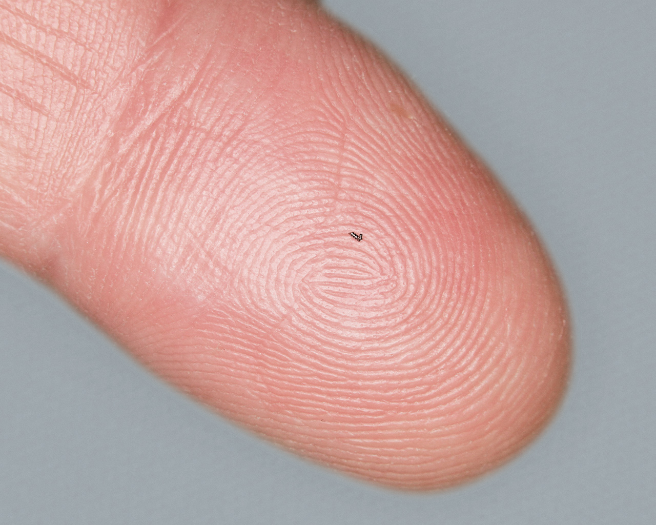 Les stents - Dr Esther Hereth Ophtalmo à Marseille